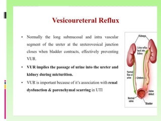 VUR & Reflux Nephropathy.pptx
