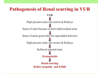 VUR & Reflux Nephropathy.pptx