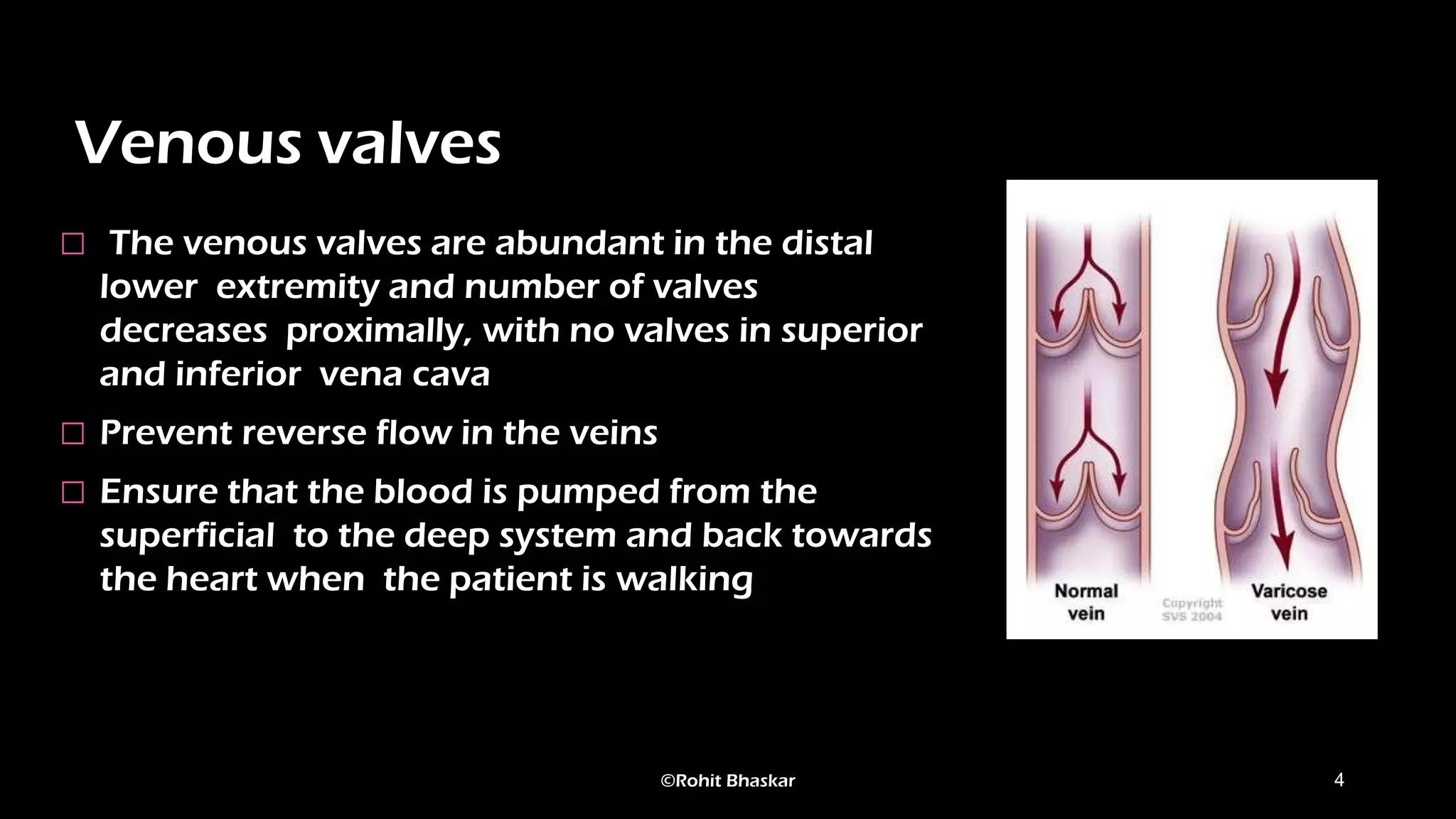 VARICOSE VEINS -Physiotherapy - Dr Rohit Bhaskar | PDF