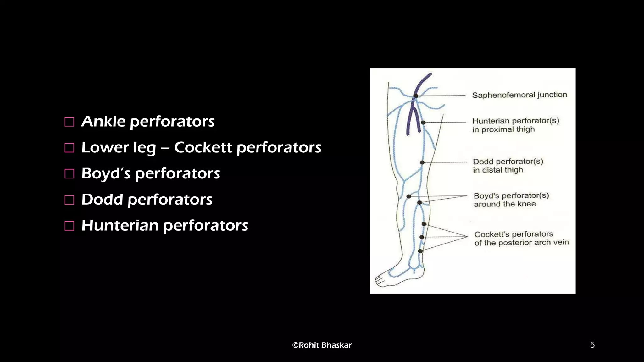 VARICOSE VEINS -Physiotherapy - Dr Rohit Bhaskar | PDF