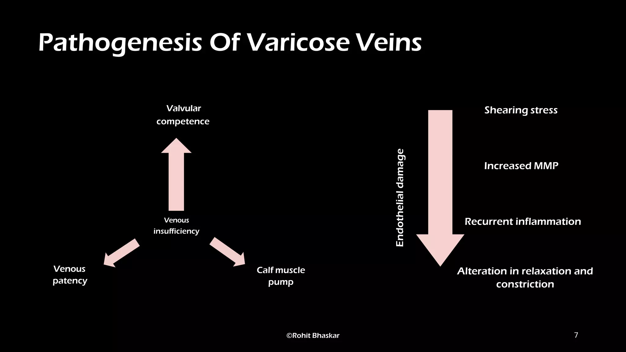 VARICOSE VEINS -Physiotherapy - Dr Rohit Bhaskar | PDF