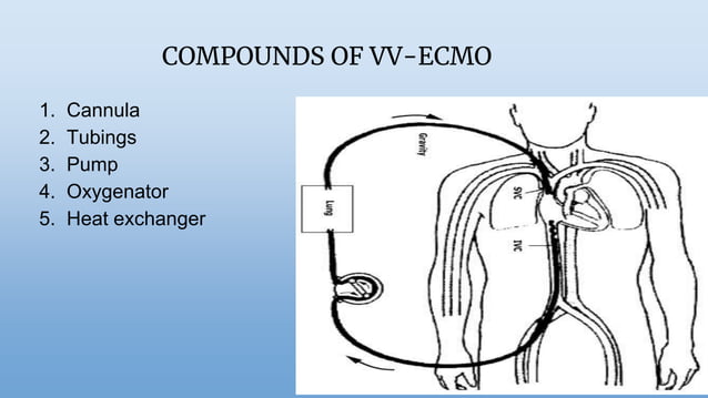 Veno-venous Extracorporeal membrane oxygenation (ECMO).pptx