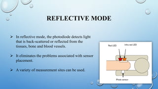 Wearable photoplethysmographic Sensors | PPTX