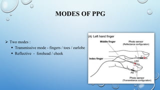 Wearable photoplethysmographic Sensors | PPTX