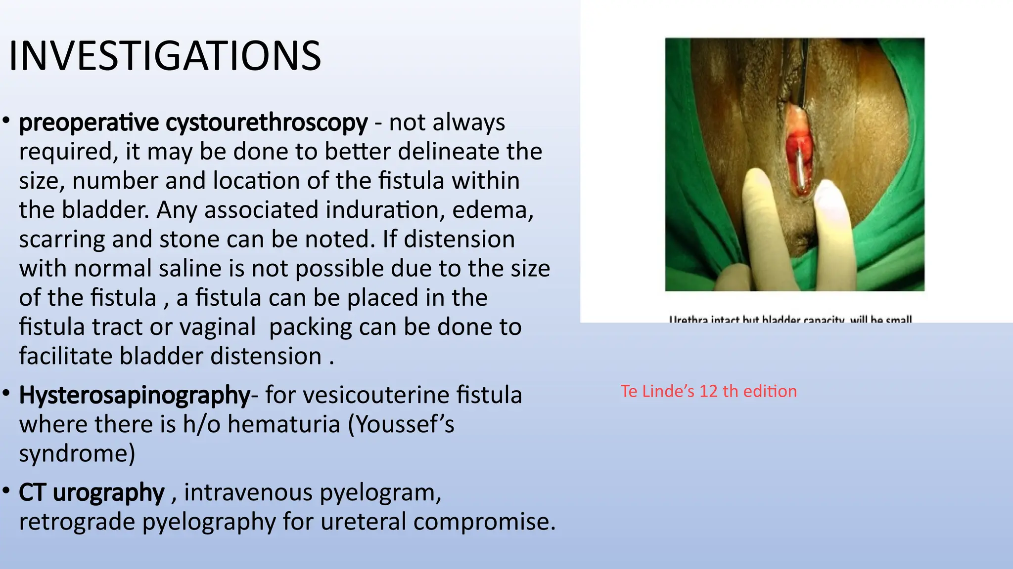 vEsicovaginal fistula vvf class edited.pptx