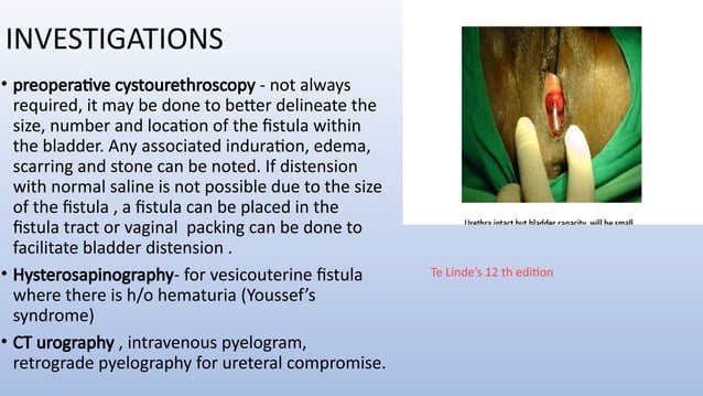 vEsicovaginal fistula vvf class edited.pptx