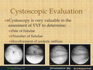 Vesicovaginal fistula evaluation | PDF