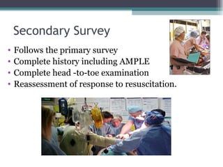 Resuscitation & abdominal trauma | PPT