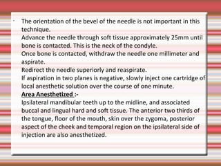 Mandibular Nerve Block - By Dr Saikat Saha | PPT