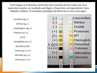 ANALISIS DE ORINA Y SEDIMENTO URINARIO | PPTX