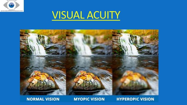 visual_acuity_(1) presentation dhir hospital bhiwani.pptx