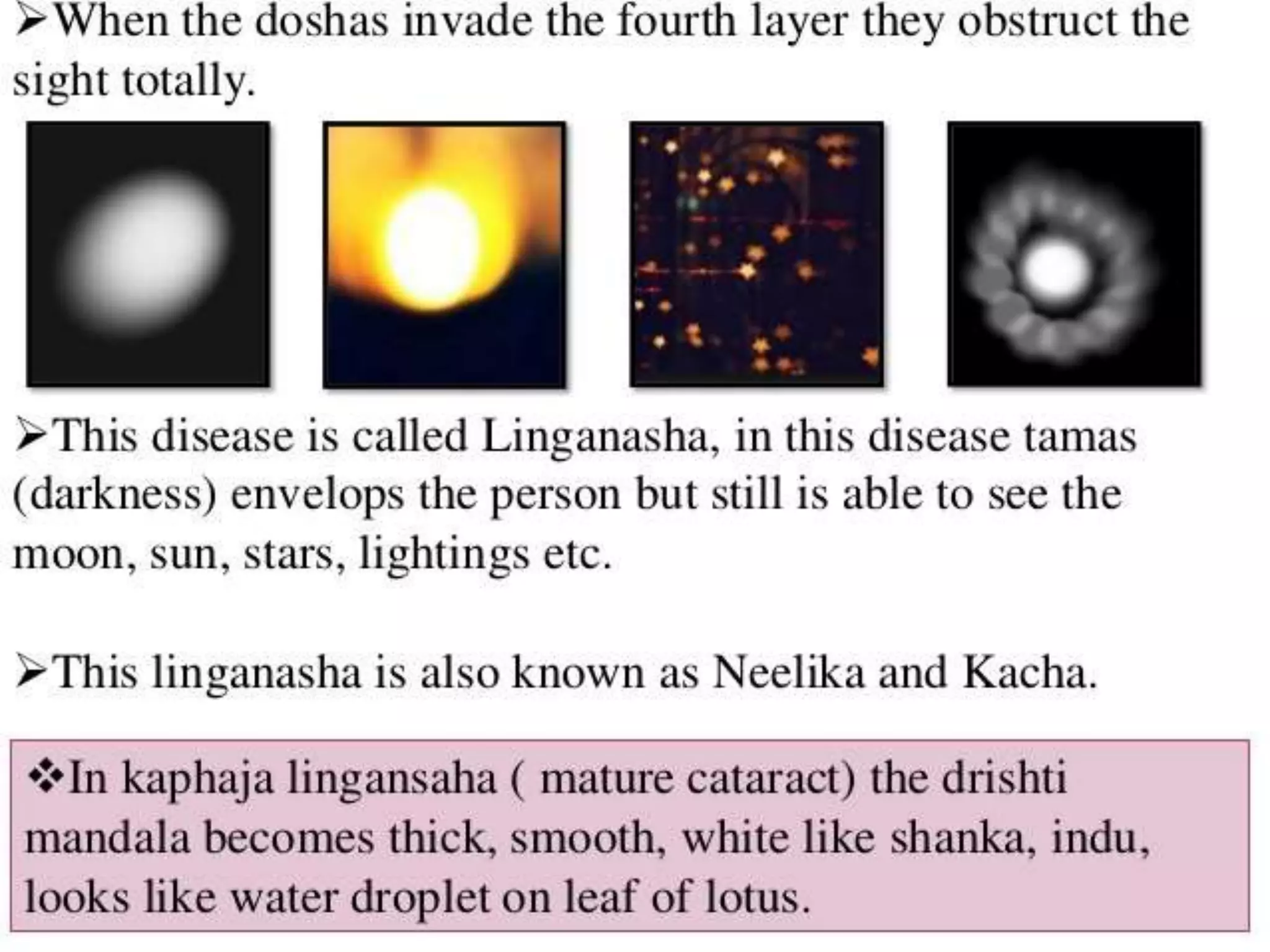 timir in ayurveda presentation | PPTX