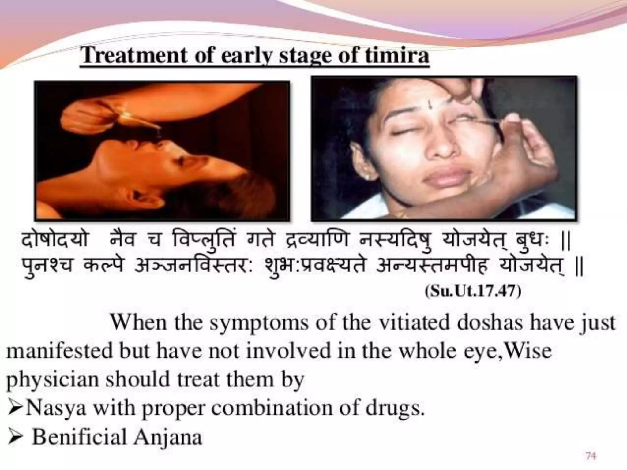 timir in ayurveda presentation | PPTX