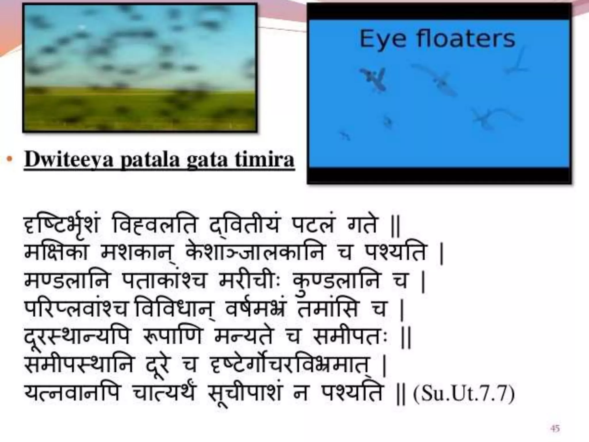 timir in ayurveda presentation | PPTX