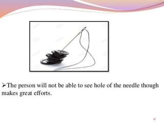 timir in ayurveda presentation | PPTX