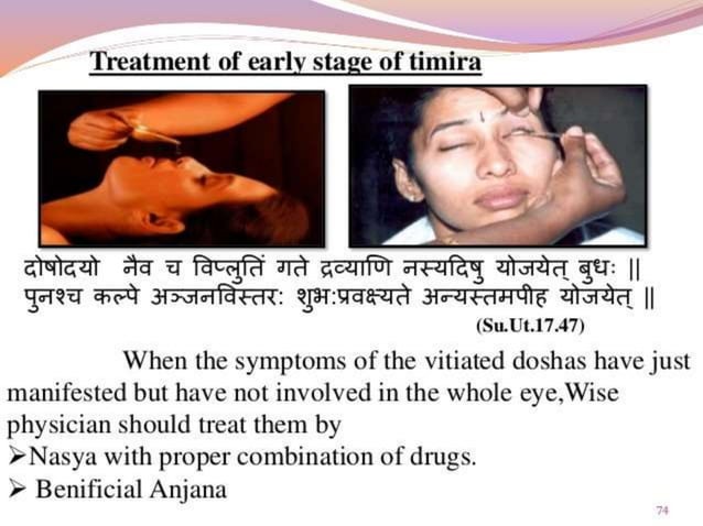 timir in ayurveda presentation | PPTX