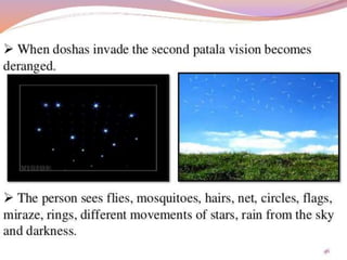 timir in ayurveda presentation | PPTX