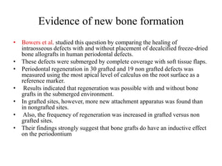 Bone grafts and periodontal | PPTX