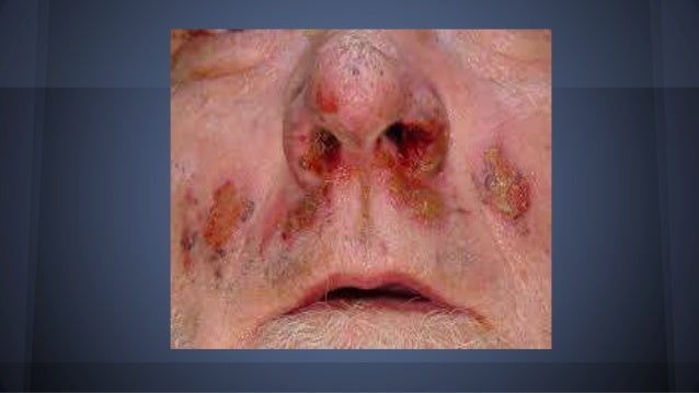 Lecture 6: Oxygen Therapy