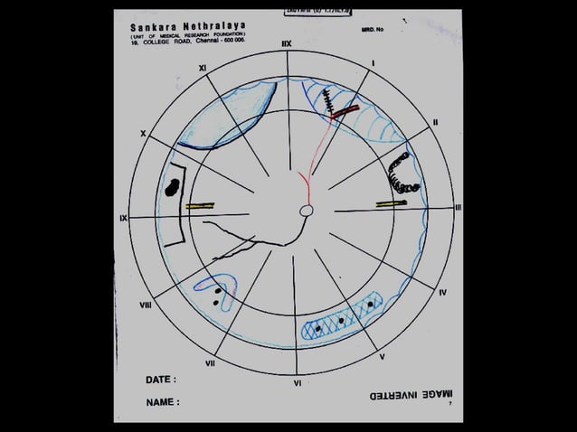 vxvmxqytqqy2ygdi6a3u-1fundus-drawing-240205192245-dbc81631.ppt