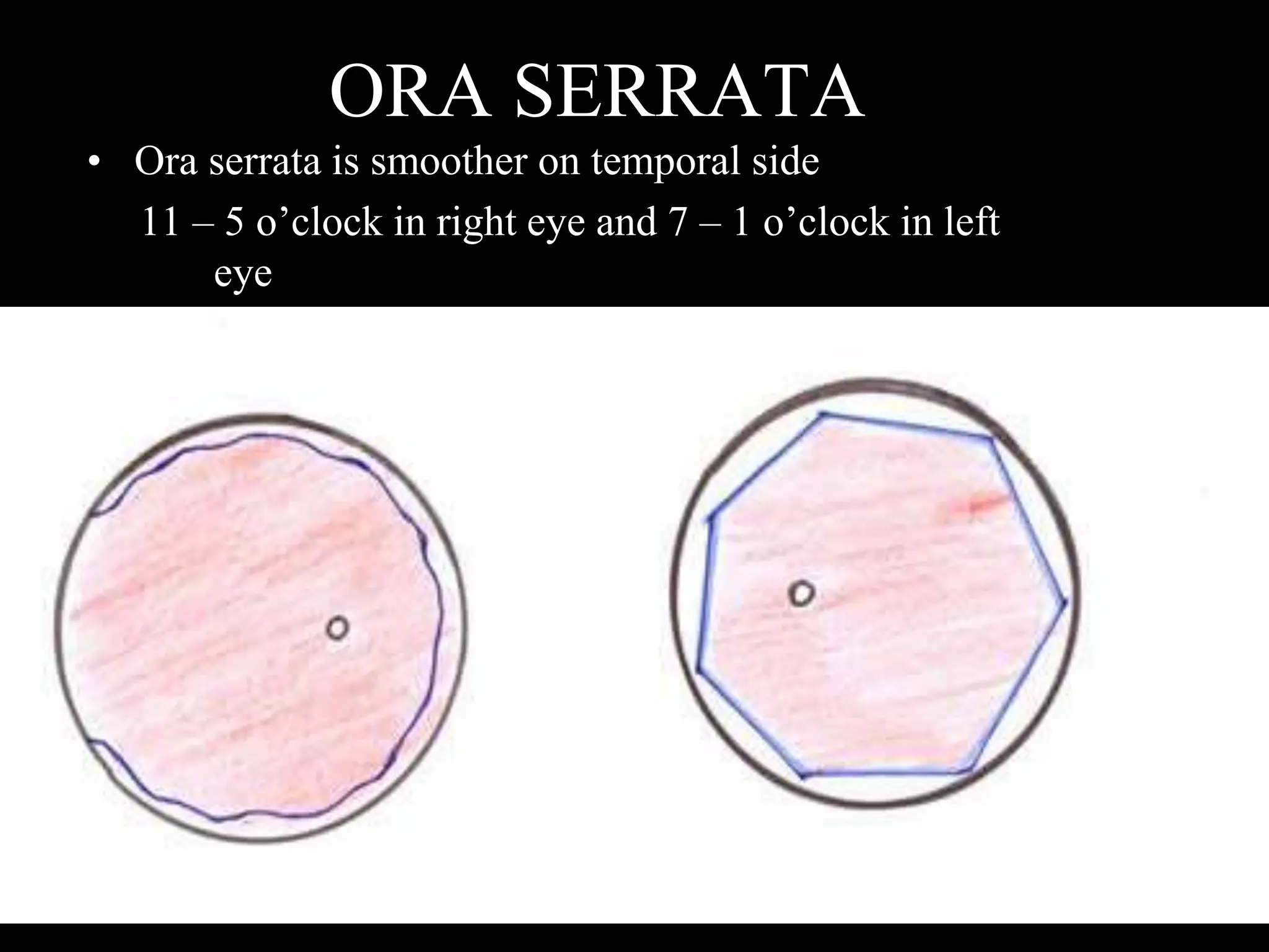 1FUNDUS_DRAWING of retina after complete examination | PPT