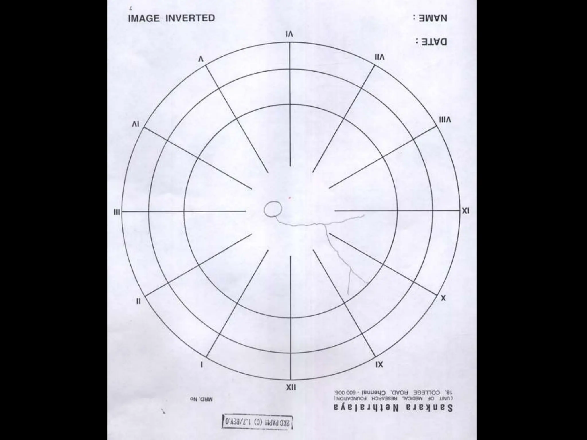 1FUNDUS_DRAWING of retina after complete examination | PPT | Eye and ...