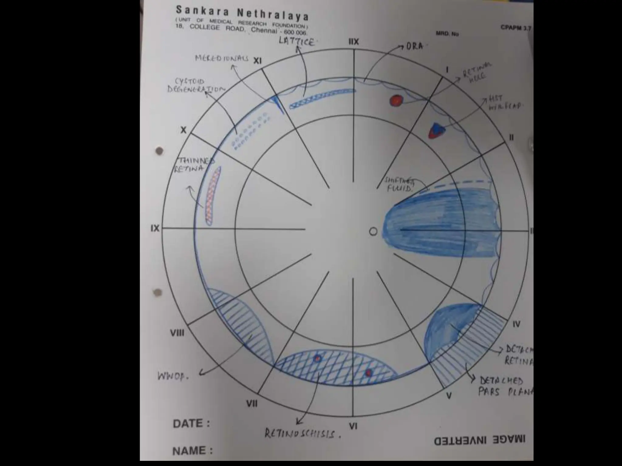 1FUNDUS_DRAWING of retina after complete examination | PPT
