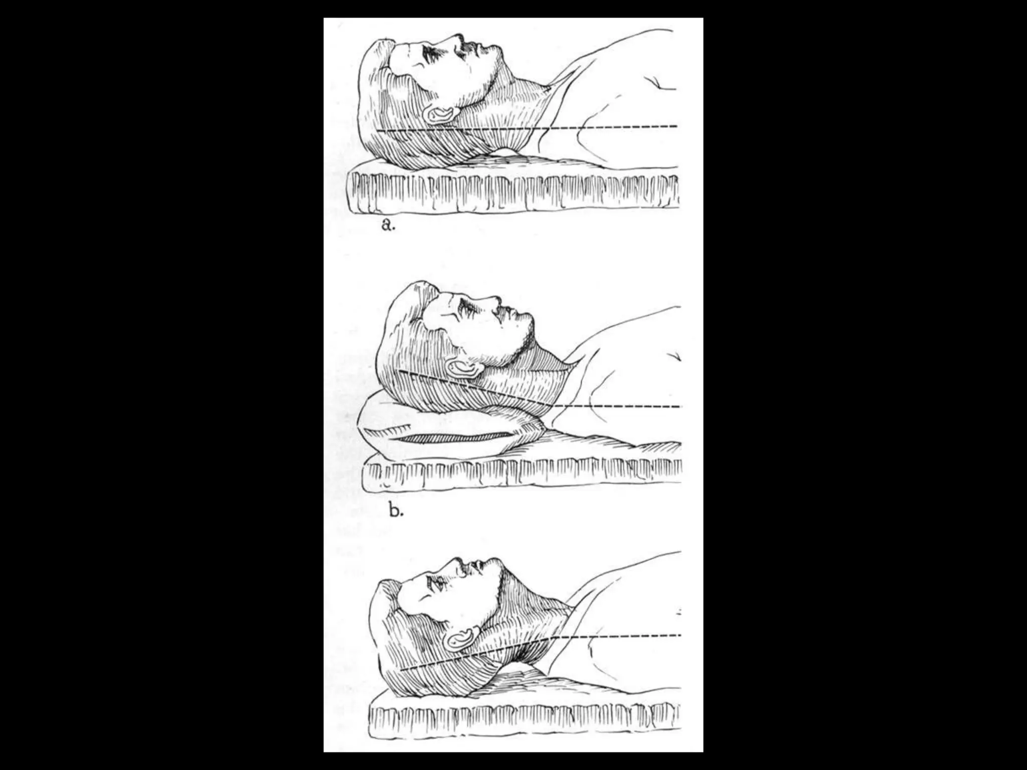 1FUNDUS_DRAWING of retina after complete examination | PPT