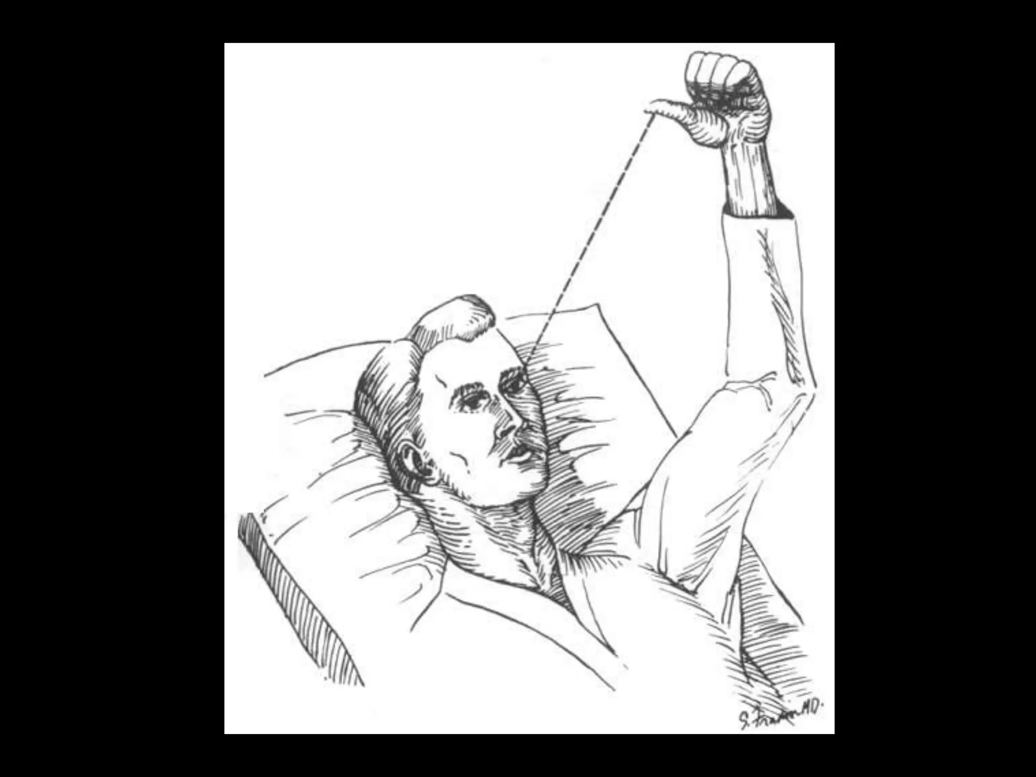 1FUNDUS_DRAWING of retina after complete examination | PPT