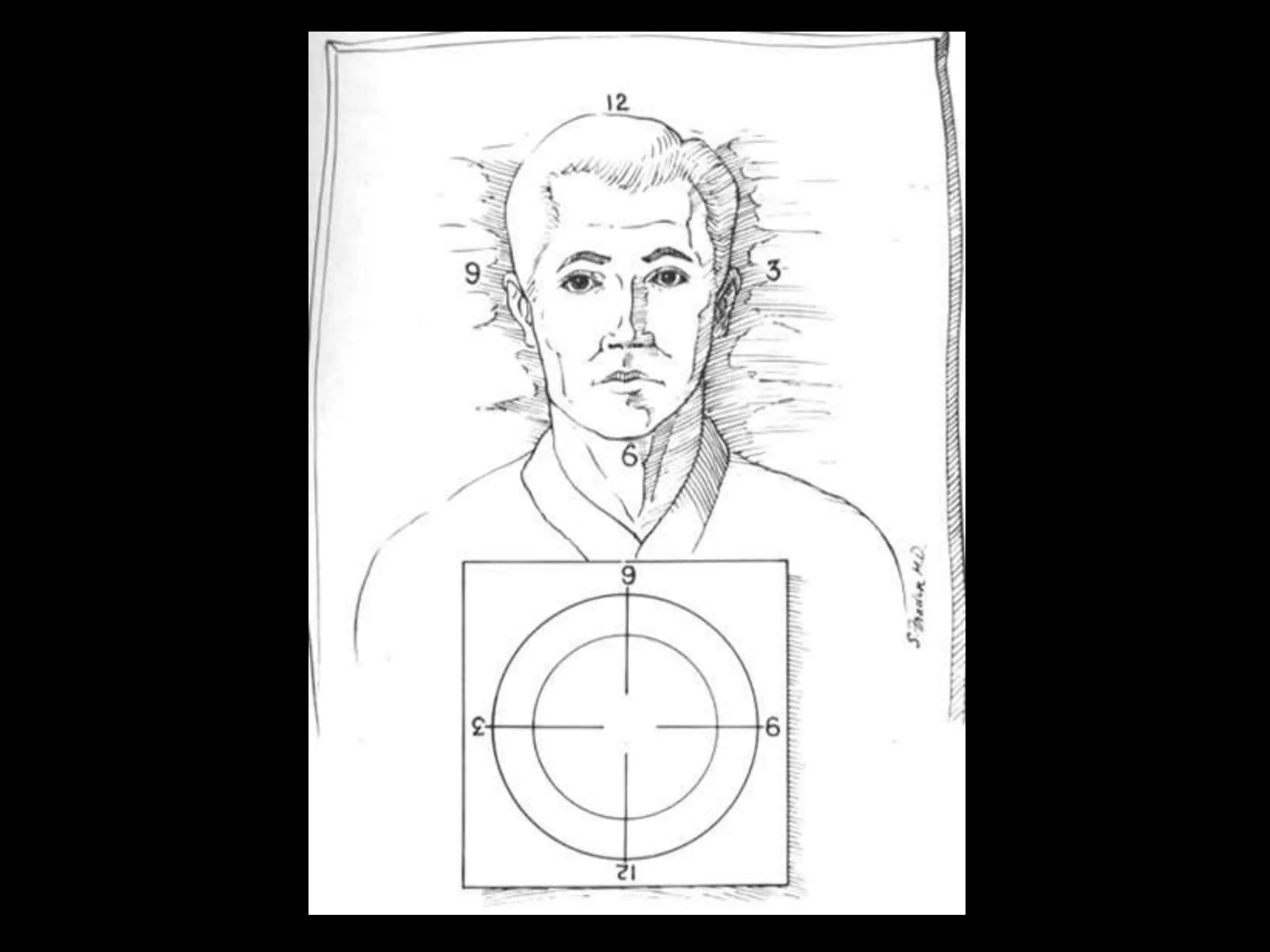 1FUNDUS_DRAWING of retina after complete examination | PPT