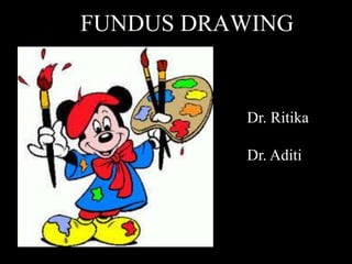 1FUNDUS_DRAWING of retina after complete examination | PPT | Eye and ...