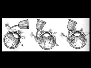 1FUNDUS_DRAWING of retina after complete examination | PPT | Eye and ...