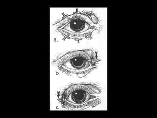 1FUNDUS_DRAWING of retina after complete examination | PPT | Eye and ...