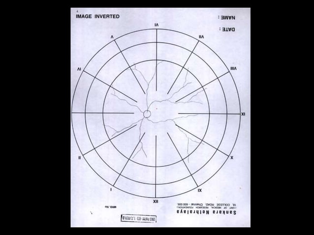 1FUNDUS_DRAWING of retina after complete examination | PPT | Eye and ...