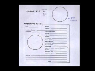 1FUNDUS_DRAWING of retina after complete examination | PPT
