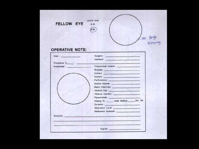 1FUNDUS_DRAWING of retina after complete examination | PPT | Eye and ...