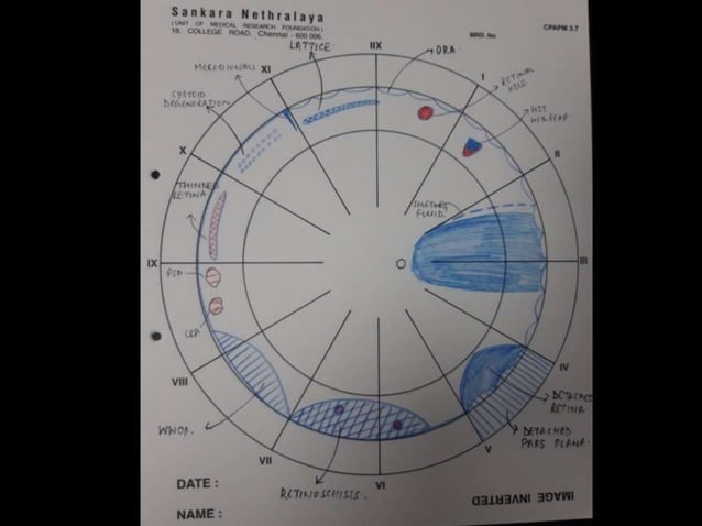 1FUNDUS_DRAWING of retina after complete examination | PPT | Eye and ...