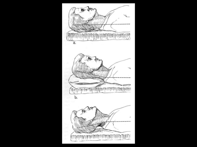 1FUNDUS_DRAWING of retina after complete examination | PPT | Eye and ...