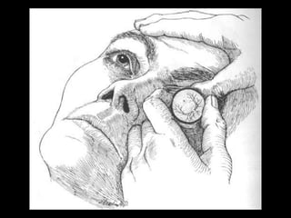 1FUNDUS_DRAWING of retina after complete examination | PPT | Eye and ...