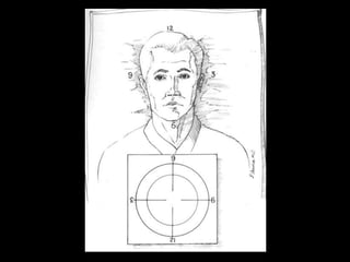 1FUNDUS_DRAWING of retina after complete examination | PPT | Eye and ...