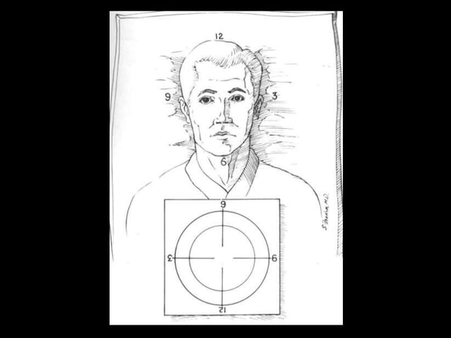 1FUNDUS_DRAWING of retina after complete examination | PPT | Eye and ...