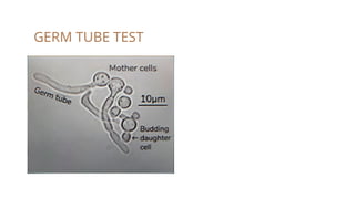 CANDIDIASIS power point presentation.pptx