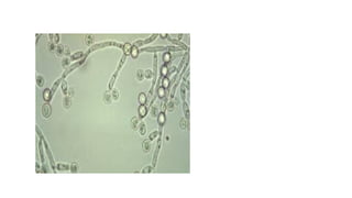 CANDIDIASIS power point presentation.pptx