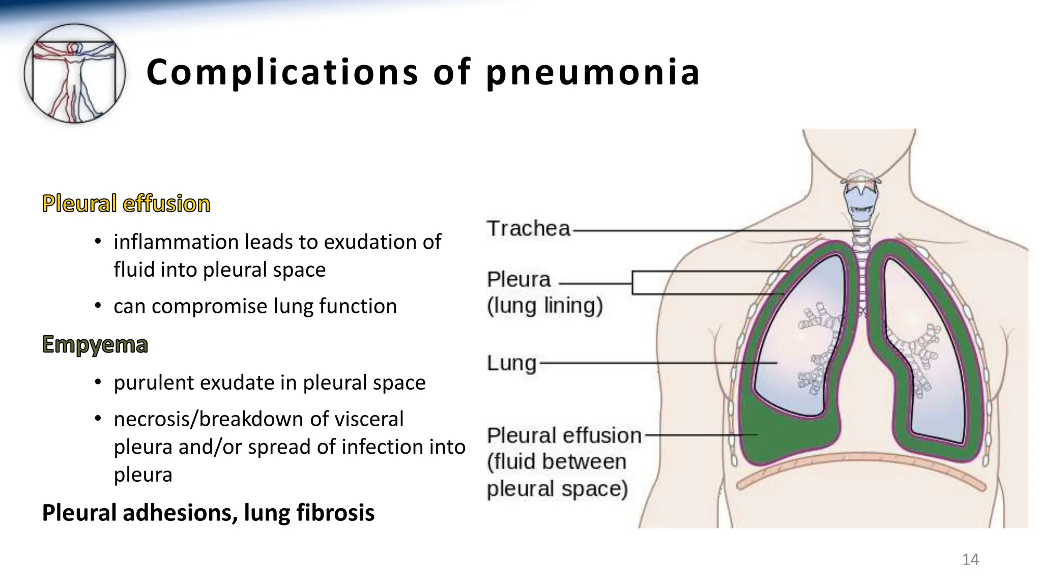 pneumonia.pptx