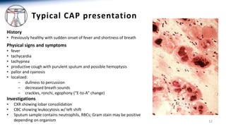 pneumonia.pptx