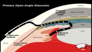 Vyzulta drug Presentation | PPTX