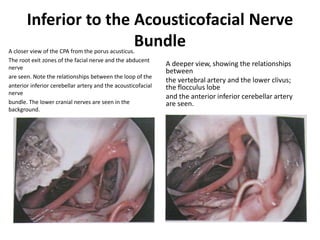 CP angle 360° | PPTX