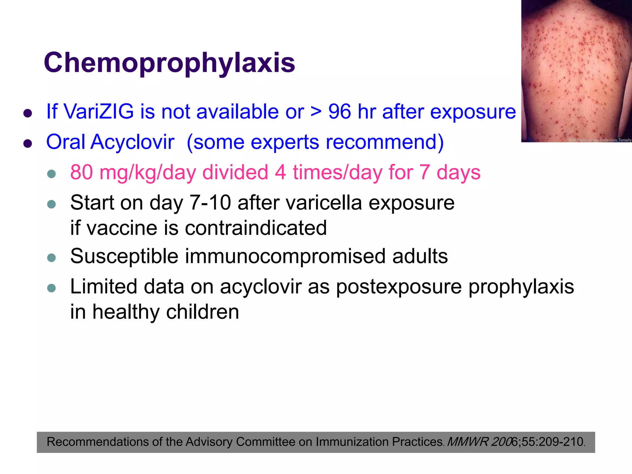 Varicella zoster virus | PDF