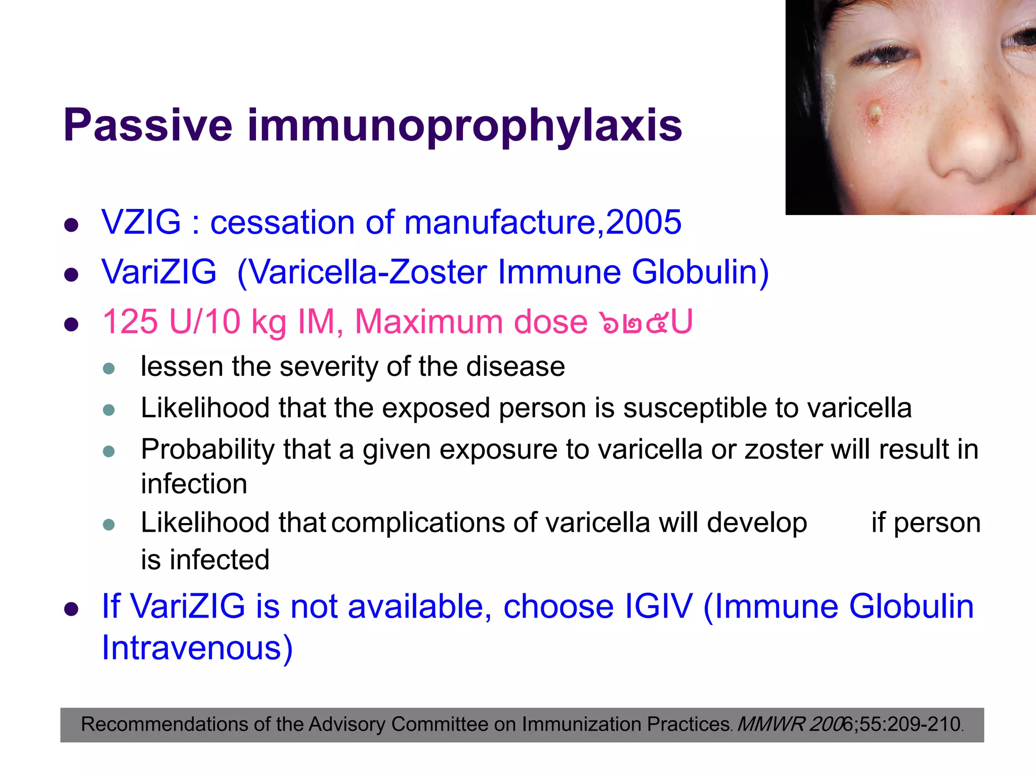 Varicella zoster virus | PDF