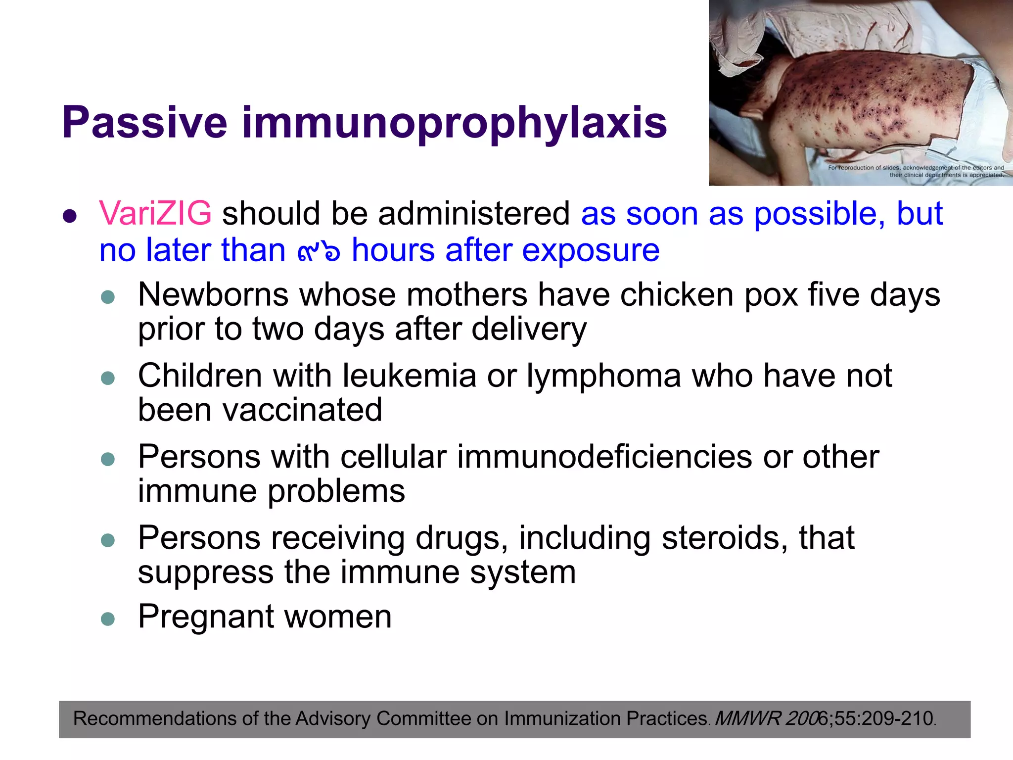 Varicella zoster virus | PDF